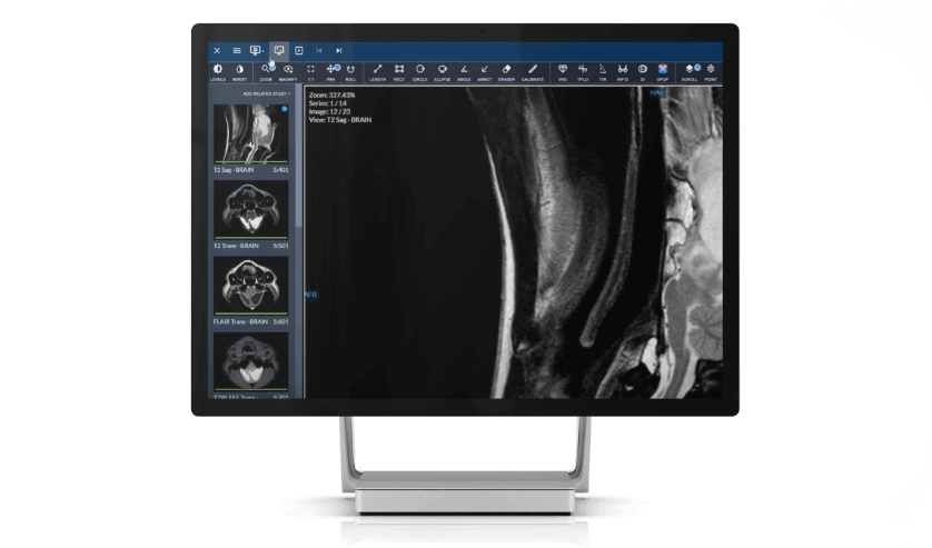 Keystone Community | Asteris Keystone PACS Platform