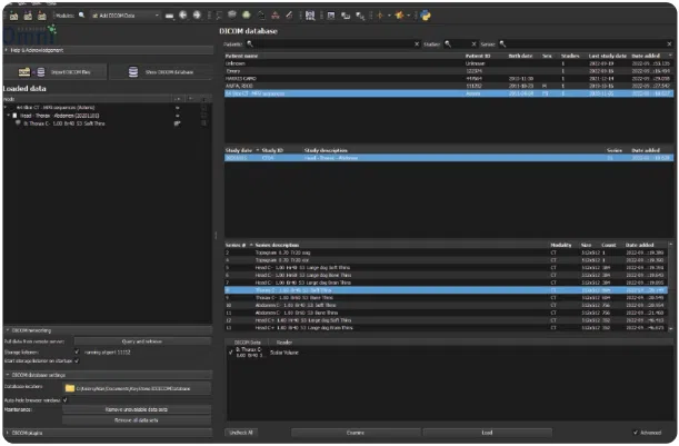 3D Volume Rendering Software for Veterinary Clinics: Keystone 3D