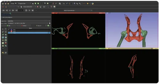 3D Volume Rendering Software for Veterinary Clinics: Keystone 3D